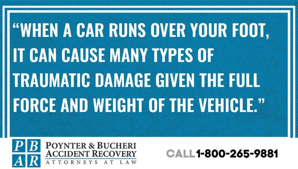 What to Do if Your Foot Gets Run Over By a Car?