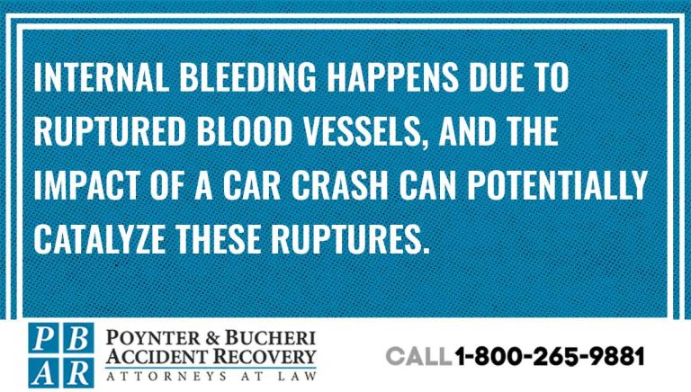Symptoms Of Internal Bleeding After A Car Accident
