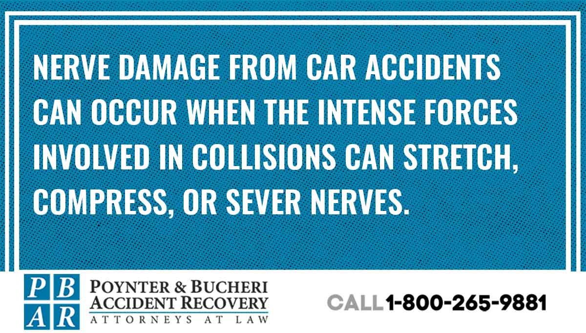 Nerve Damage from Car Accident Settlement: A Guide